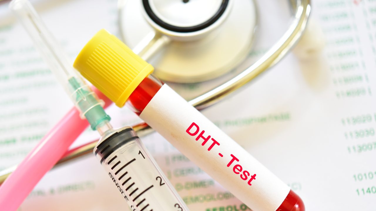 Understanding the Effectiveness of DHT Blockers in Hair Growth and ...